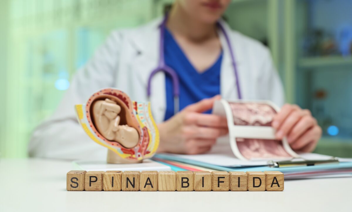 Rázštep chrbtice. Nový výskum skúma náplasť s kmeňovými bunkami ešte ...